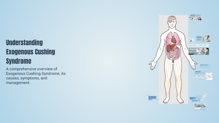 Understanding Exogenous Cushing Syndrome by Alin Deleanu on Prezi