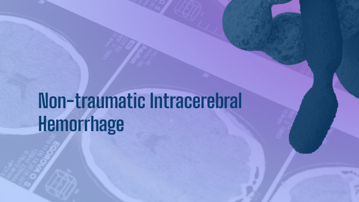 Non-traumatic Intracerebral Hemorrhage by Peter Alexander Secher on Prezi