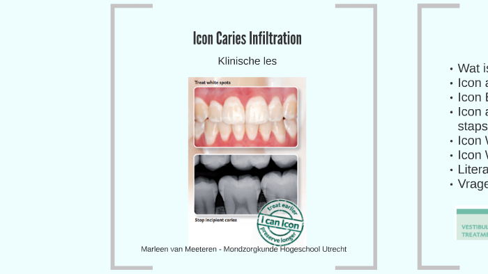 Icon Caries Infiltration by Marleen van Meeteren on Prezi