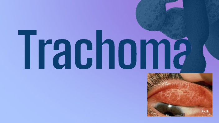 trachom by Sara Rahati on Prezi