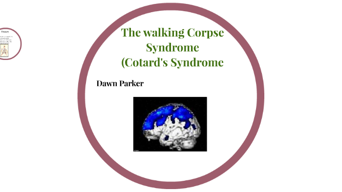 The walking Corpse Syndrome by Dawn Parker on Prezi