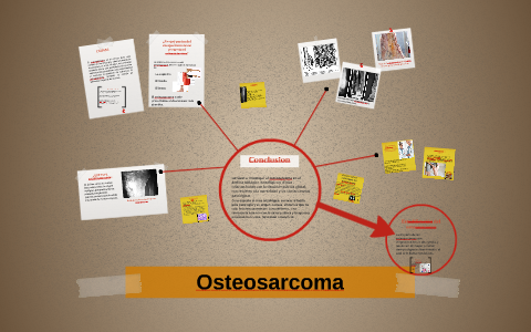 Osteosarcoma by Camila Guarin on Prezi