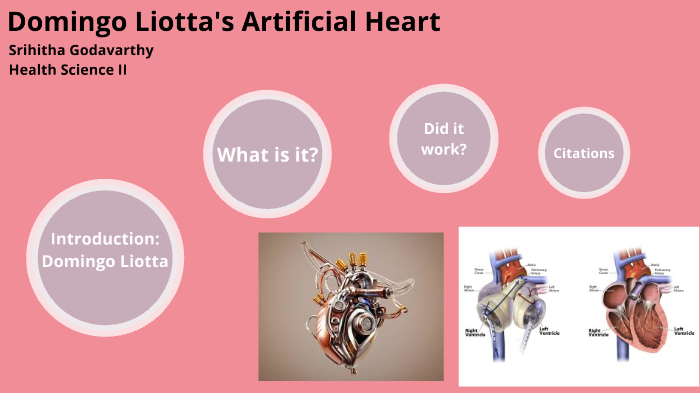 Domingo Liotta Invention by Srihitha Godavarthy on Prezi