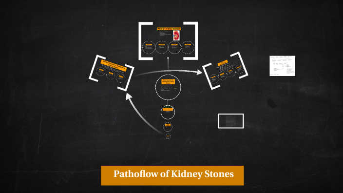 PathoFlow Kidney Stones by Arlen Dayrit on Prezi