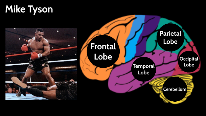 Celebrity Brain Project by ANTONIO 0205319 on Prezi Celebrity Brain Project by ANTONIO 0205319 on Prezi