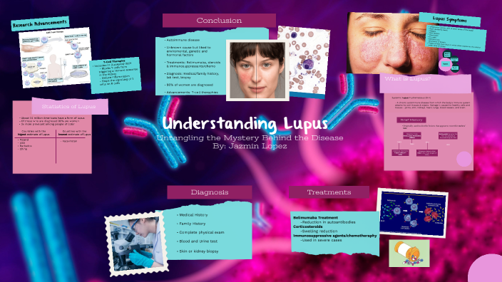 Understanding Lupus by Jazmin Lopez on Prezi
