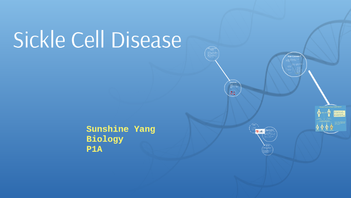 Sickle Cell Disease by Sunshine Yang on Prezi