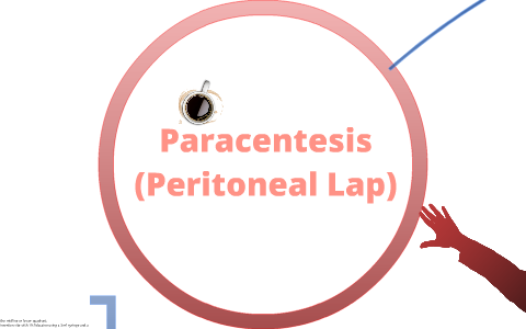 Paracentesis (Peritoneal lap) by kai del castillo on Prezi