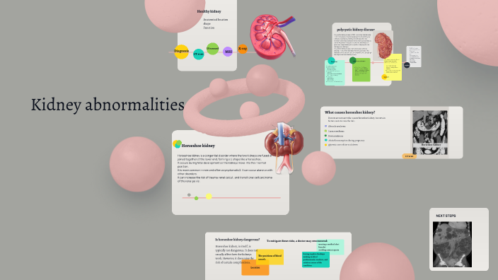 Abnormal kidney by Atena Sheikh Asadi on Prezi
