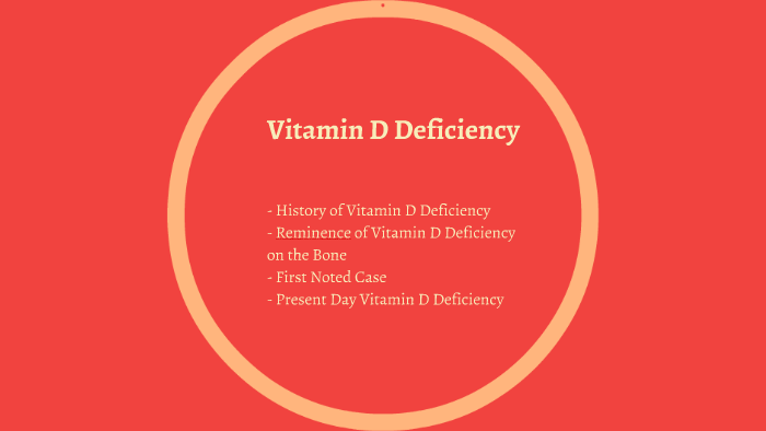 Vitamin D Deficeny by Anna Wilke on Prezi