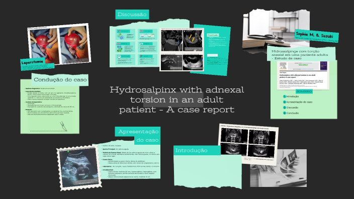 Hydrosalpinx with adnexal torsion in an adult patient–A case report by ...