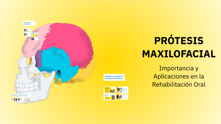 PRÓTESIS MAXILOFACIAL by Jorge Gastelum Heinrichs on Prezi