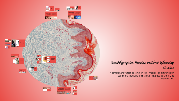 Dermatology: Infectious Dermatoses and Chronic Inflammatory Conditions ...