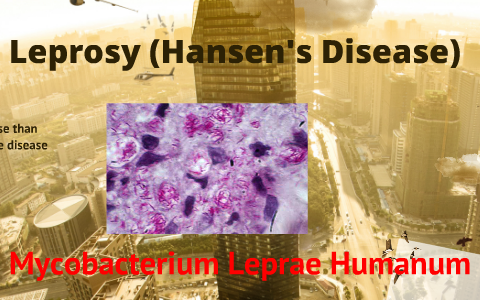 Microbe Wanted Poster Project by Katherine Guerrero on Prezi