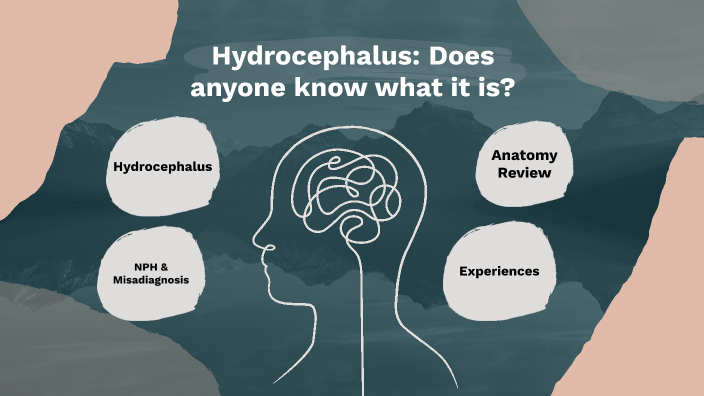 Hydrocephalus Do You Know What It Is By Anna Marchesi On Prezi