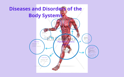 Diseases and Disorders of the Body Systems by mialice bell on Prezi