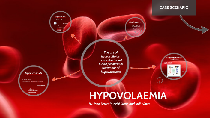 Hypovolaemia presentation by jodi watts on Prezi