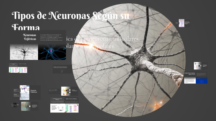 Tipos de Neuronas Según su Forma by keisy johana on Prezi