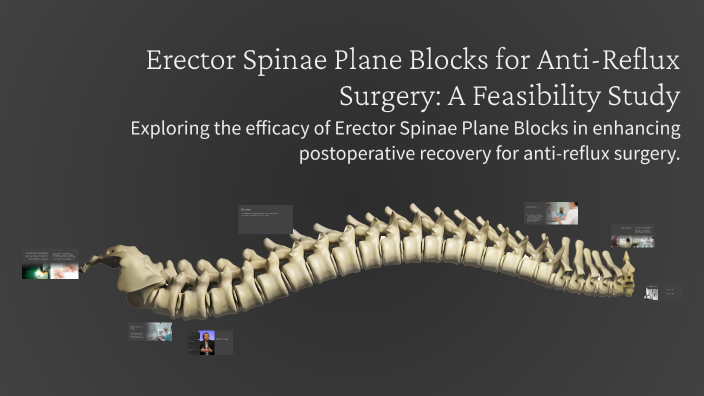 Erector Spinae Plane Blocks for Anti-Reflux Surgery: A Feasibility ...