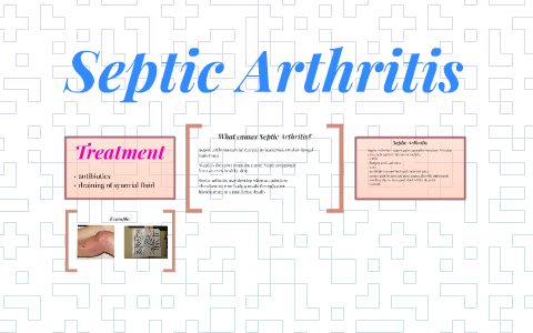 What causes Septic Arthritis by DaMonte Jones on Prezi