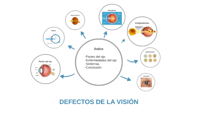 DEFECTOS DE LA VISIÓN by Belén Morgado Jiménez on Prezi