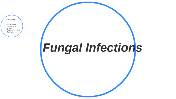 Fungal Infections by Kirby Hatley on Prezi