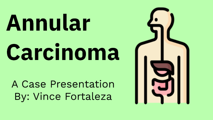 Annular Carcinoma Case Presentation by Vince Jarryd Ortiz Fortaleza on ...