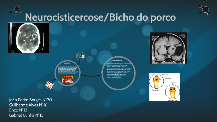 Neurocisticercose by João Rocha on Prezi