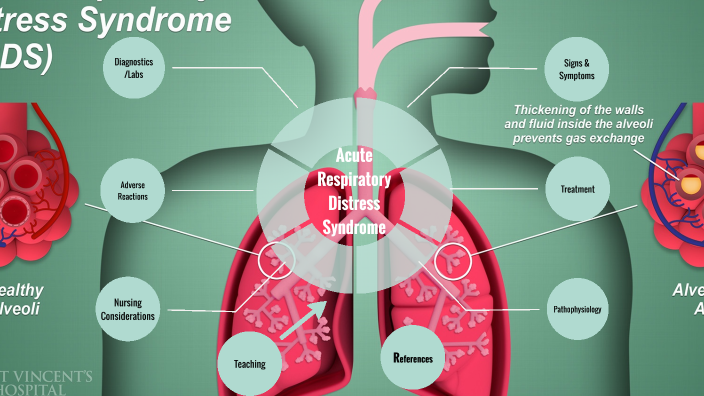 Pathophysiology Concept Map by Amanda Barrozo on Prezi