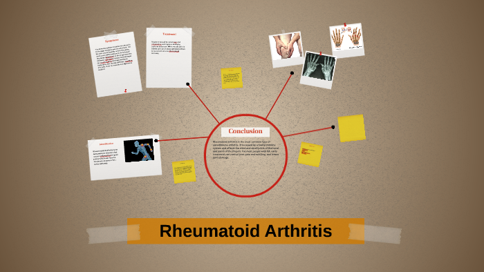Rheumatoid Arthritis by morgan rowbotham on Prezi