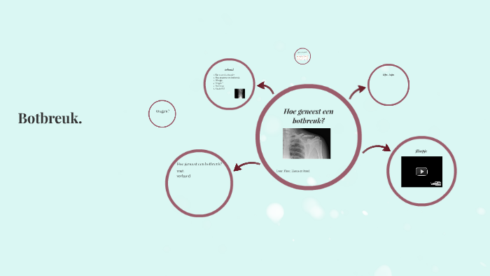 Hoe geneest een botbreuk by lucas dijkstra on Prezi