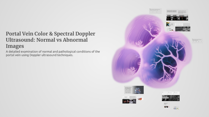 Portal Vein Color & Spectral Doppler Ultrasound: Normal vs Abnormal ...