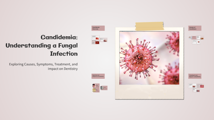 Candidemia: Understanding a Fungal Infection by Diamond Serrano on Prezi