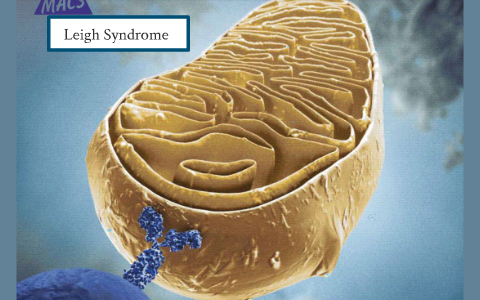 Leigh Syndrome by Ben Amos on Prezi