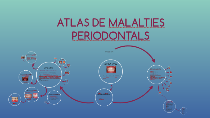 ATLAS DE MALALTIES PERIODONTALS by Nicole Cerrato on Prezi