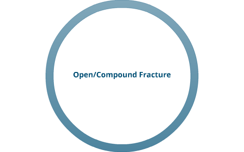 Open/Compound Fracture by Brock fish on Prezi