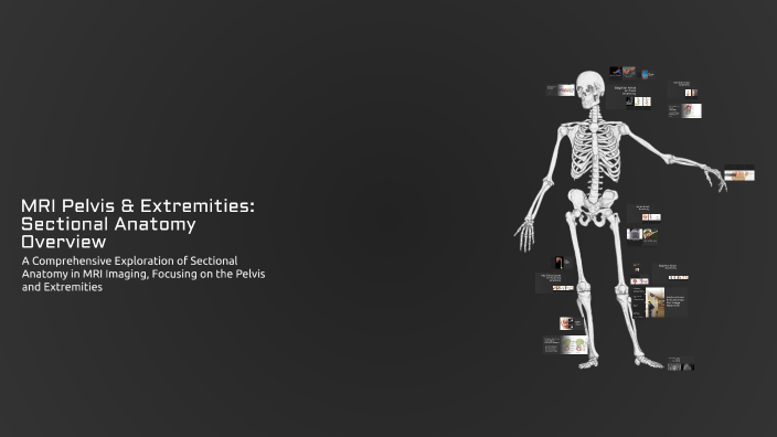 MRI Pelvis & Extremities: Sectional Anatomy Overview by Veronica ...
