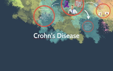 Crohn's Disease by Kole Klement on Prezi