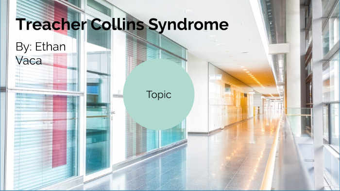 Treacher Collins Syndrome by Ethan Vaca on Prezi
