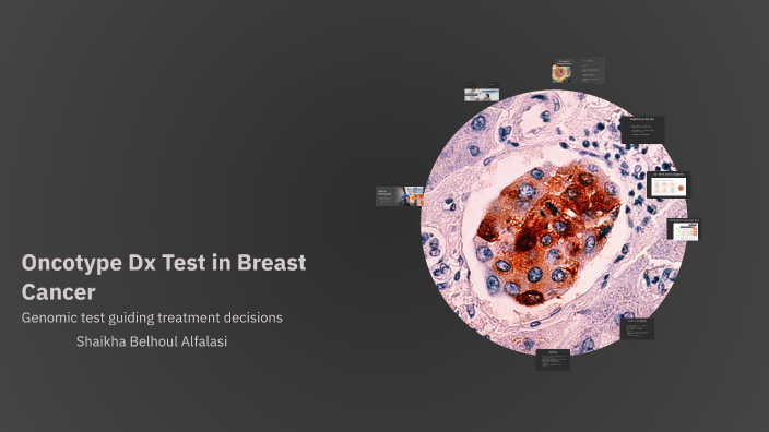 Understanding Oncotype DX Testing for Breast Cancer by shaikha belhoul ...