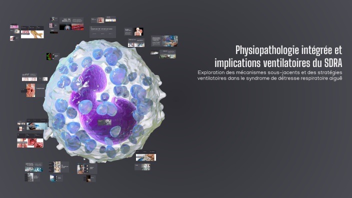 Physiopathologie intégrée et implications ventilatoires du SDRA by ...
