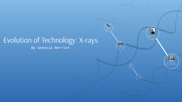 Evolution of Technology: X-rays by Genesis Berrios on Prezi