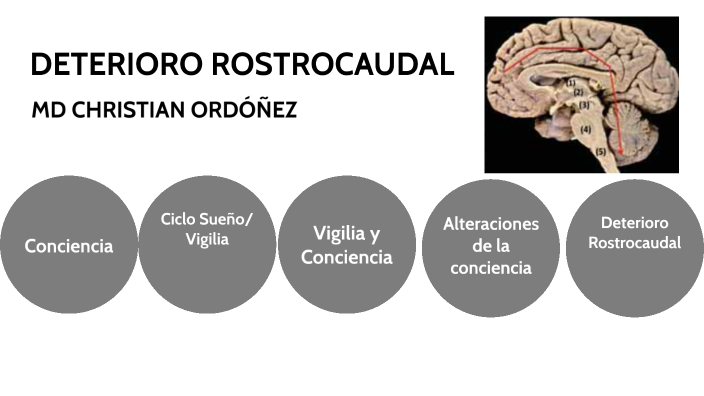 DETERIORO CEFALOCAUDAL by Cristian Ordonez on Prezi