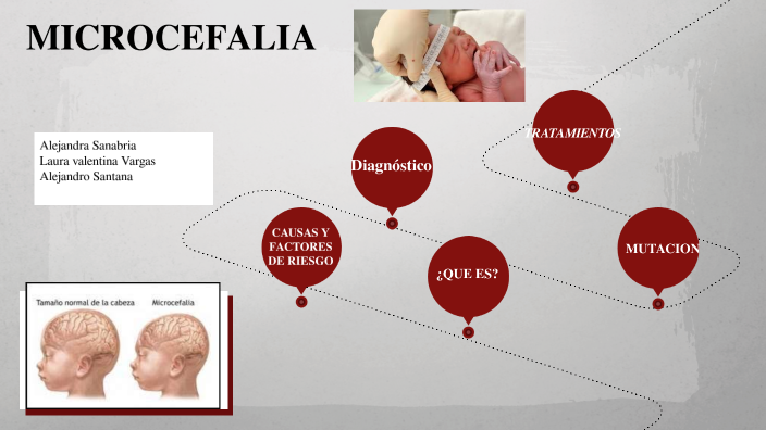 MICROCEFALIA by Alejandra Sanabria Henao on Prezi
