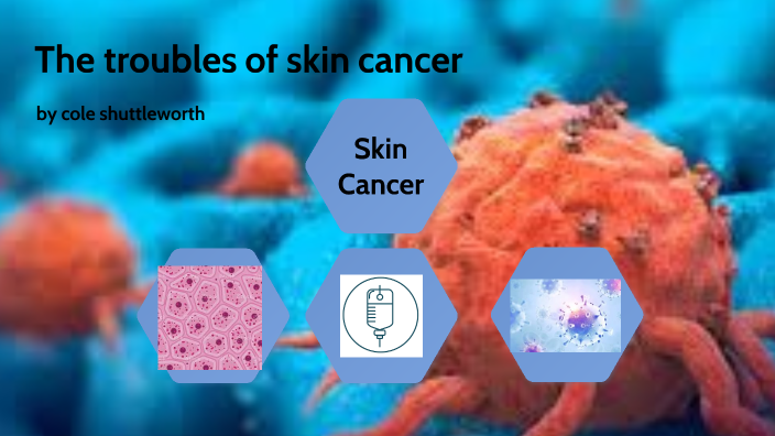 CS- skin cancer project by cole shuttleworth on Prezi