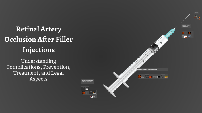 Retinal Artery Occlusion After Filler Injections by kubra cabuk on Prezi