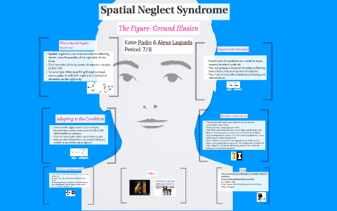 Spatial Neglect Syndrome by Katie Alexa on Prezi