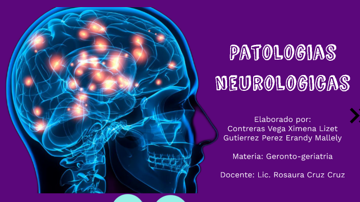 Patologias neurologicas by Erandy Gutierrez on Prezi