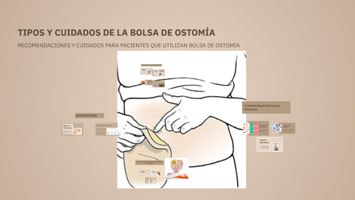 TIPOS Y CUIDADOS DE LA BOLSA DE OSTOMIA by Espinoza Vélez Jamilet on Prezi