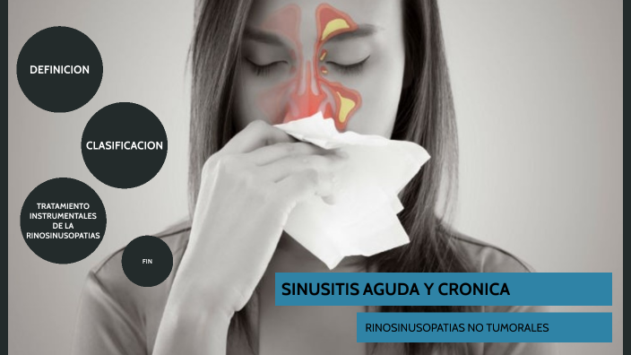 sinusitis cronica y aguda by Gustavo Marca Arce on Prezi